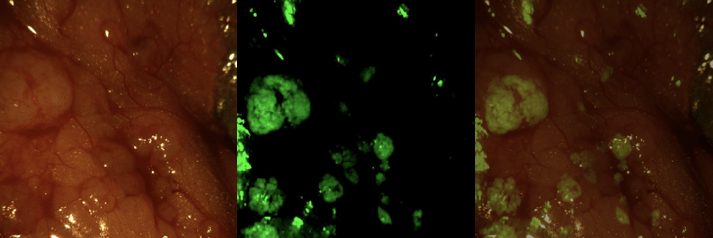 Molecular imaging in drug development | TRACER