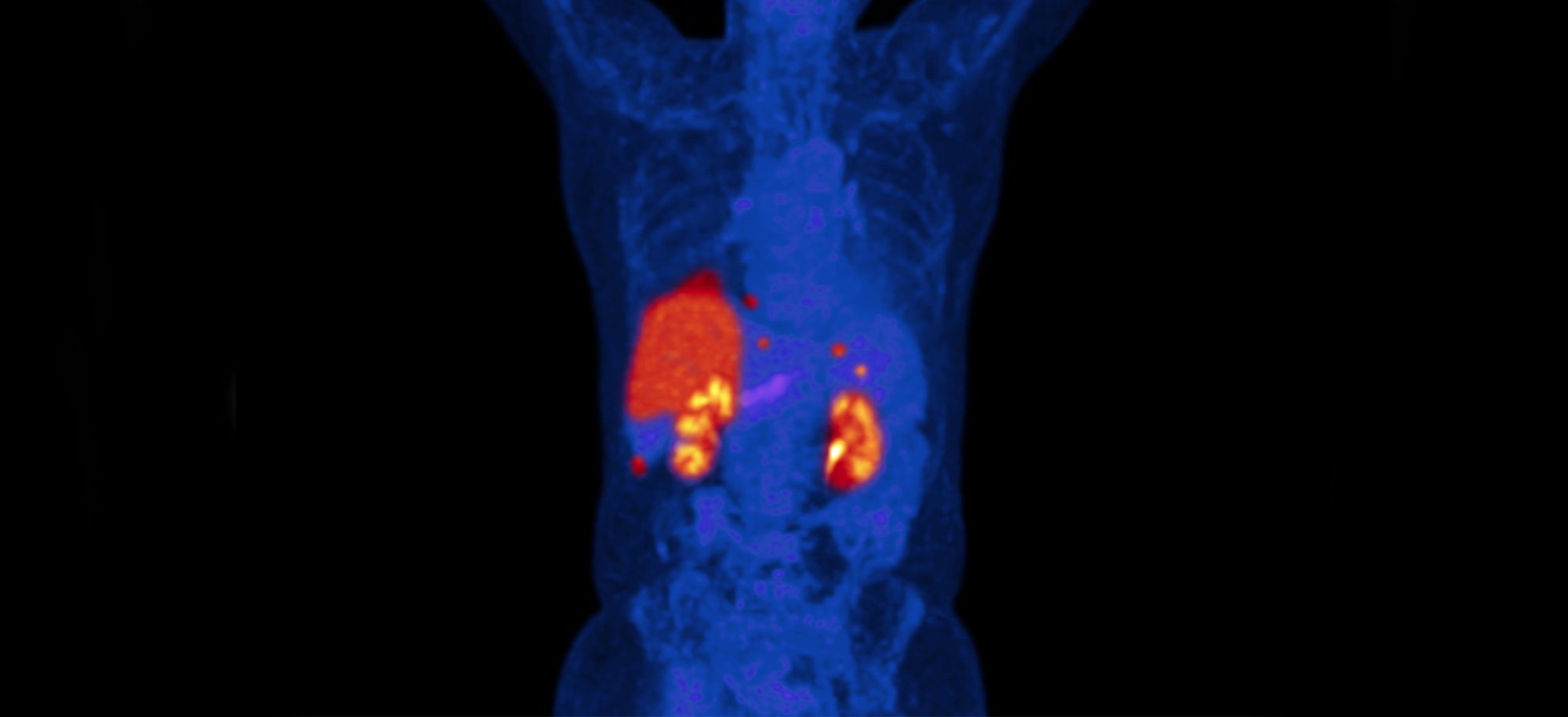 Nuclear molecular imaging | Fastest Clinical Research | TRACER