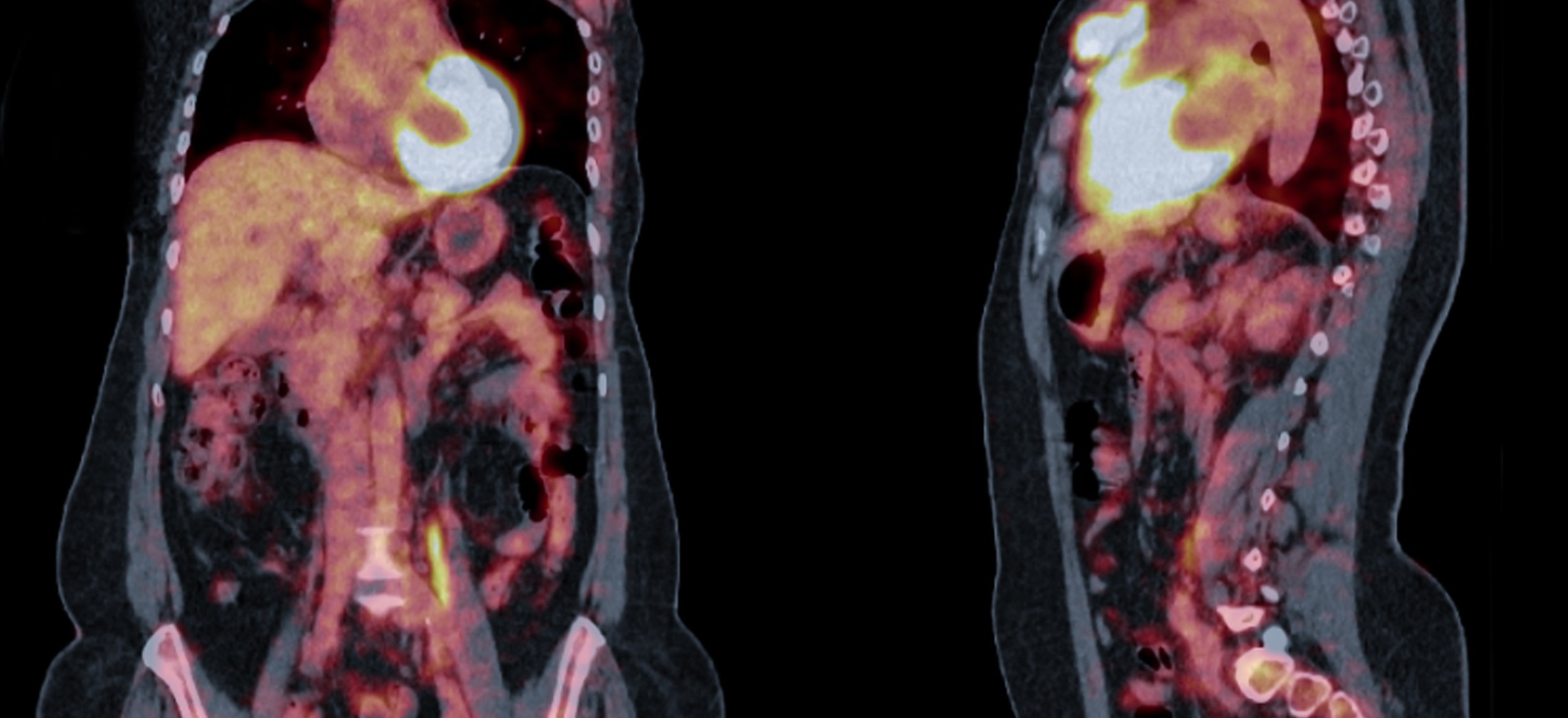 Nuclear molecular imaging | Fastest Clinical Research | TRACER